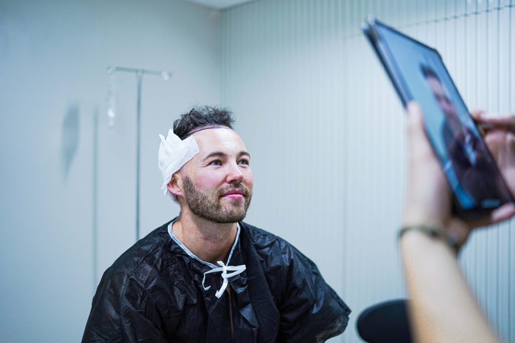 3000 Grafts Hair Transplant: Cost, Coverage & Results - Hermest Clinic