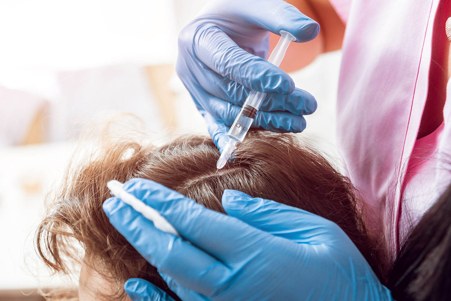 PRP vs Hair Transplant: Best Option for Your Stage of Hair Loss